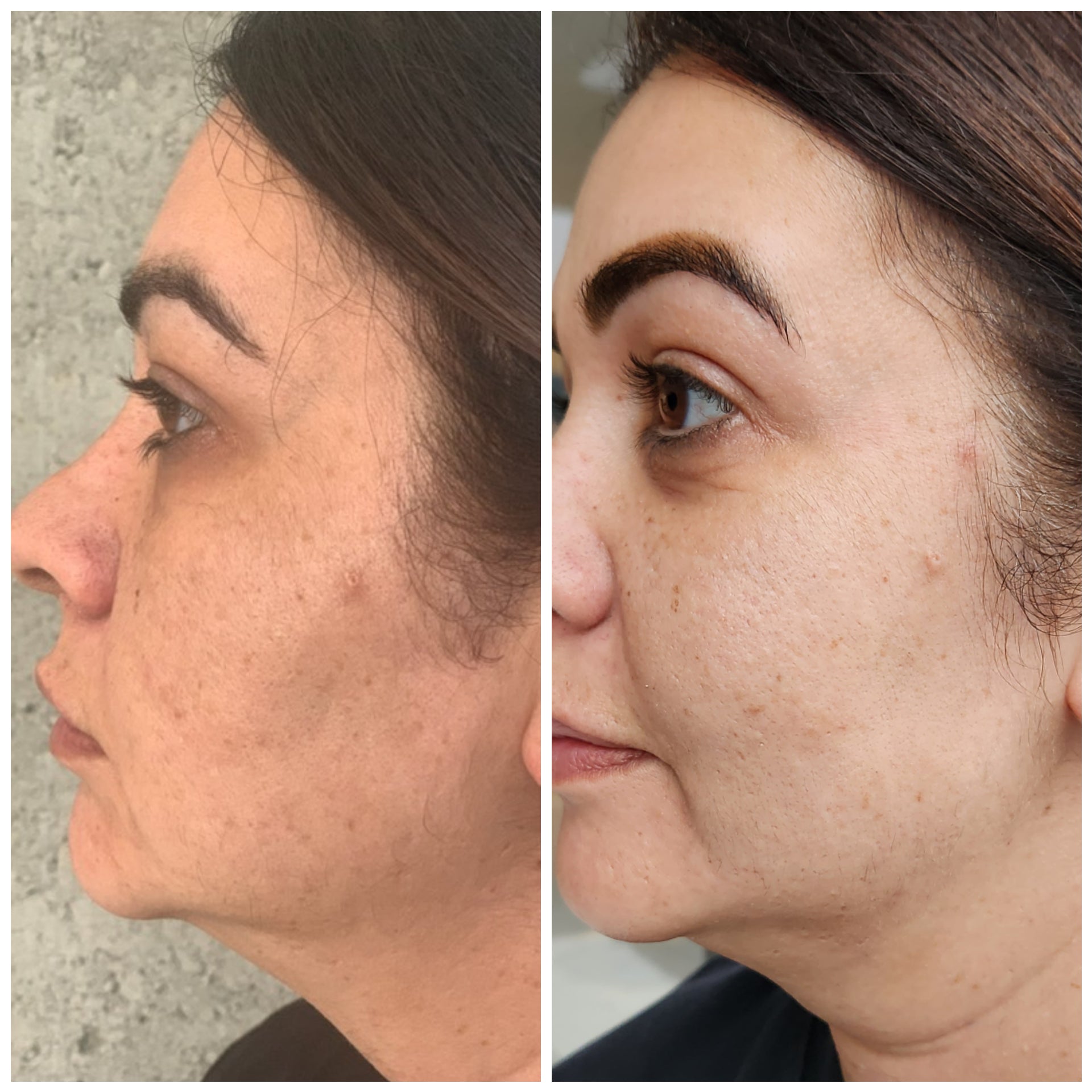 Above Skin – ABOVE SKIN